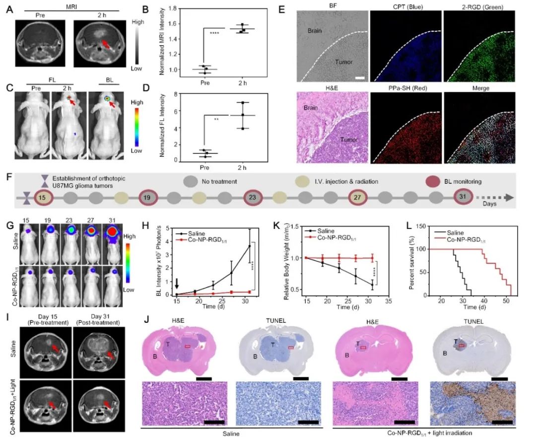 上海科技党建-上海药物所合作开发纳米探针用于脑胶质瘤的成像与治疗