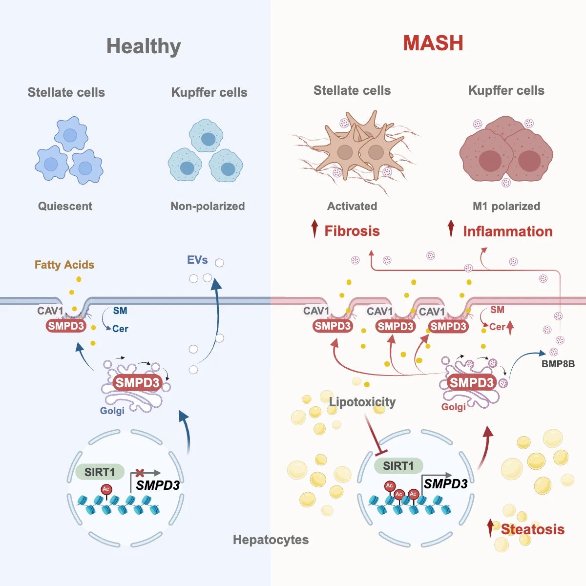 上海科技党建-Cell Metab | 上海药物所合作揭示靶向肝细胞膜鞘脂代谢改善MASH的机制
